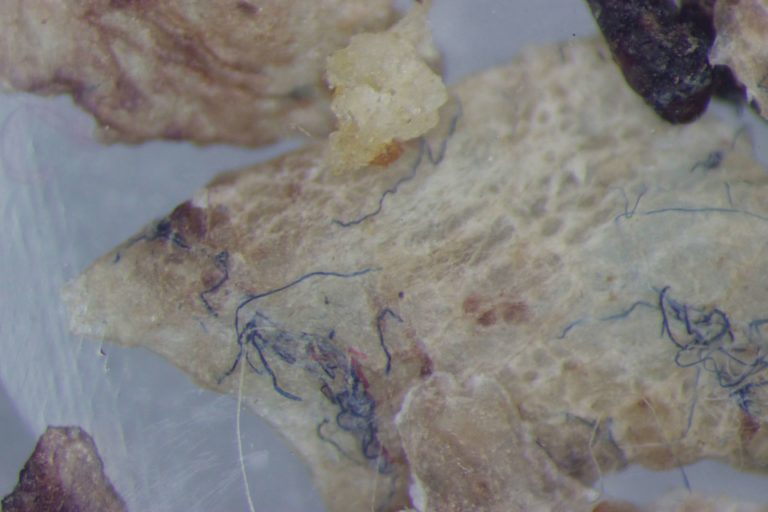 Morgellons Book - Morgellons Specialist Dr. Ginger Savely